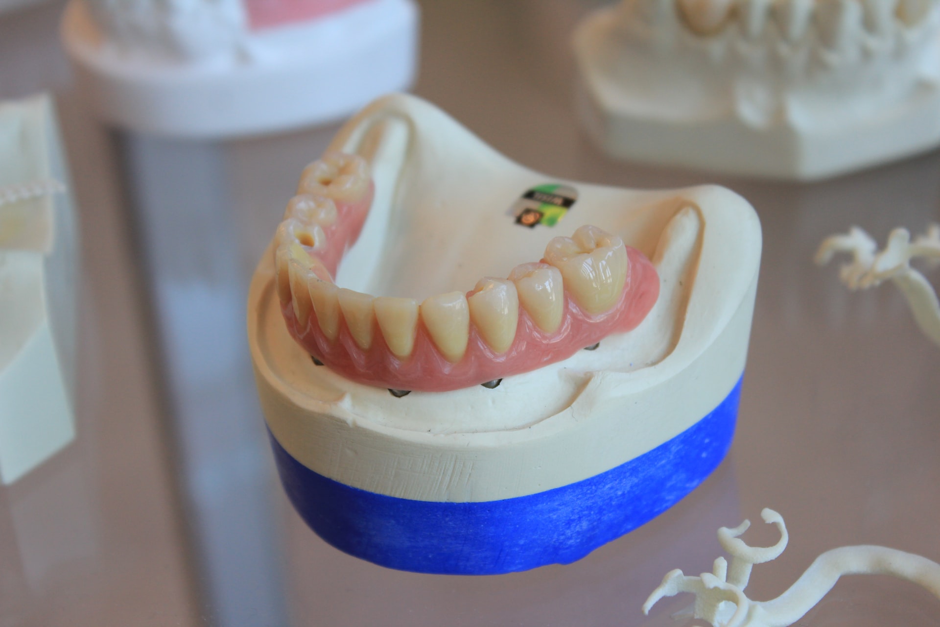 Things to Consider Before Getting a Dental Crown Things to Consider Before Getting a Dental Crown